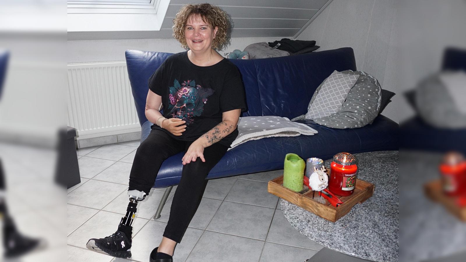 Nach der Sepsis: 48-Jährige aus Heilsbronn lebt mit Prothesen | FLZ.de